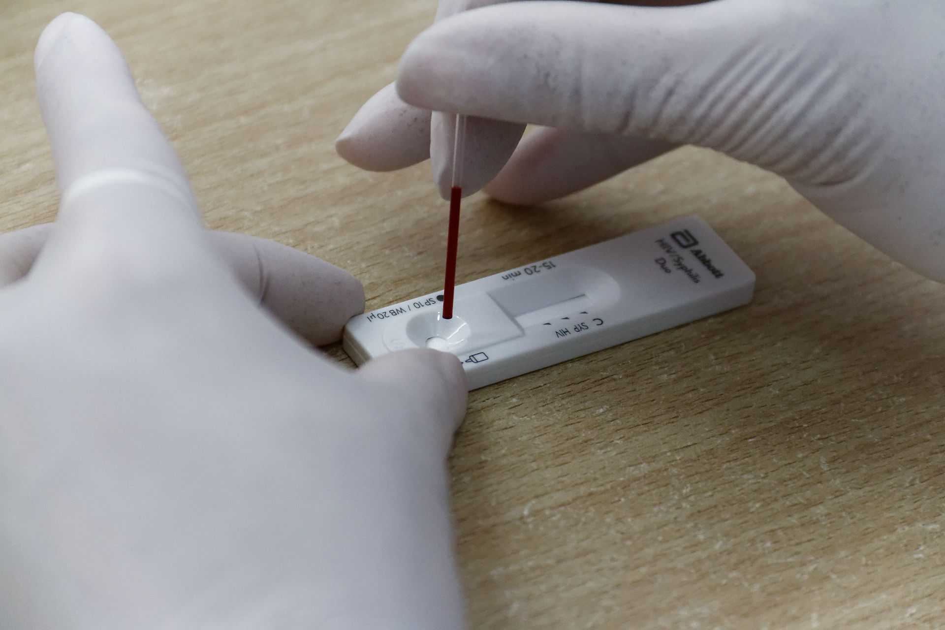 Jornada de Concientización por el Día Nacional del Testeo Rápido de VIH ...